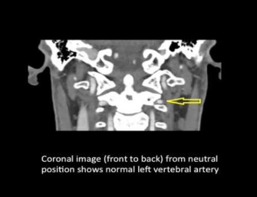 How to Read an MRI of the Thoracic Spine | Spine Anatomy