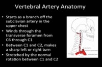 Vertebrobasilar Artery Syndrome | Vertebrobasilar Artery Ischemia ...
