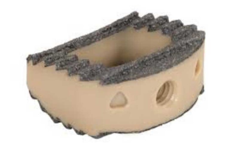 Anterior Cervical Decompression & Fusion (ACDF) | Spine Surgeon